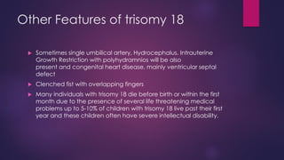 Trisomy 18 group 3 | PDF