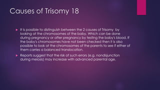 Trisomy 18 group 3 | PDF