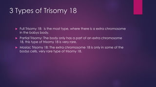 Trisomy 18 group 3 | PDF