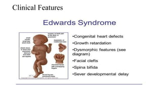 Trisomy 21 and other chromosomal abnormalities | PPTX
