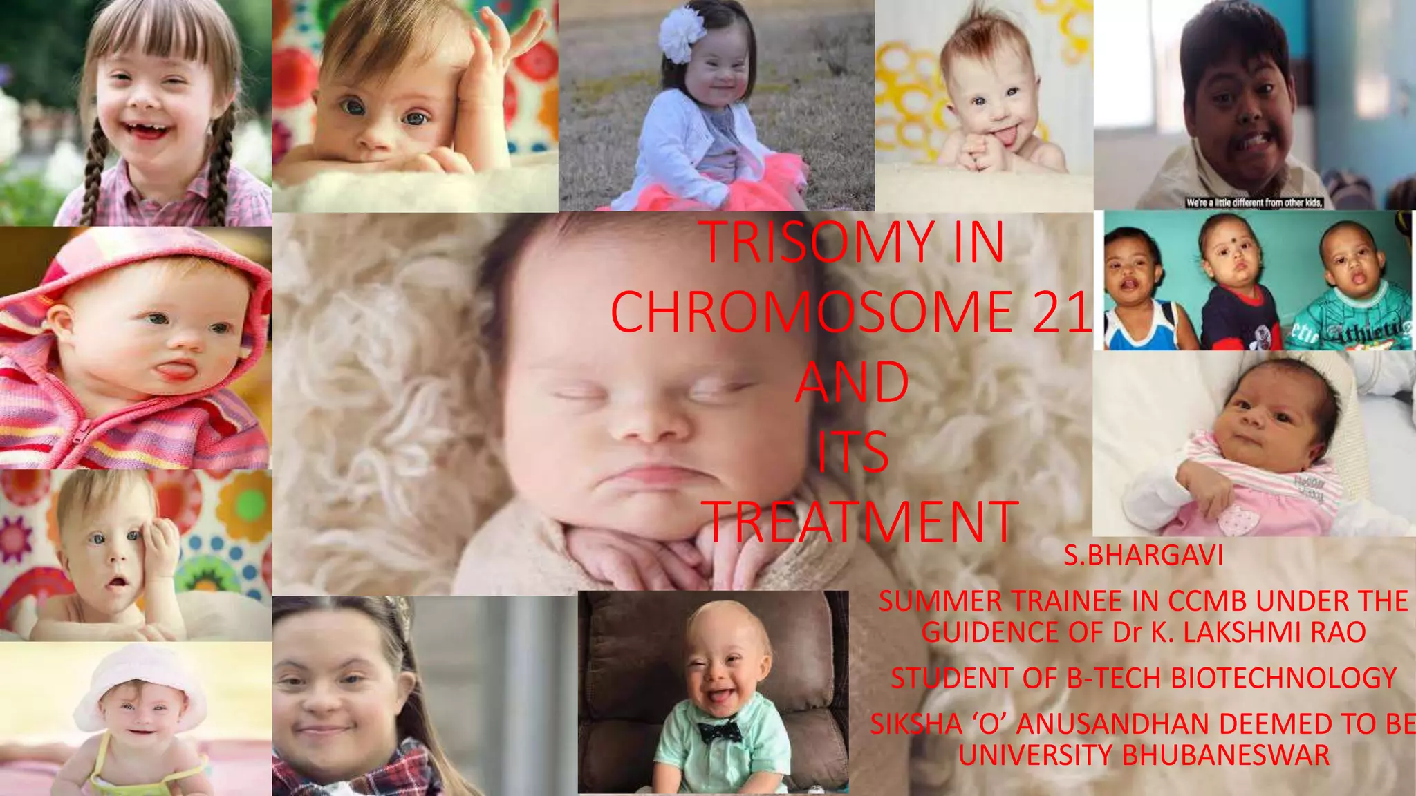 Trisomy in chromosomes and Down Syndrome | PPT