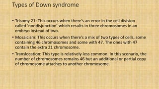 Trisomy in chromosomes and Down Syndrome | PPT