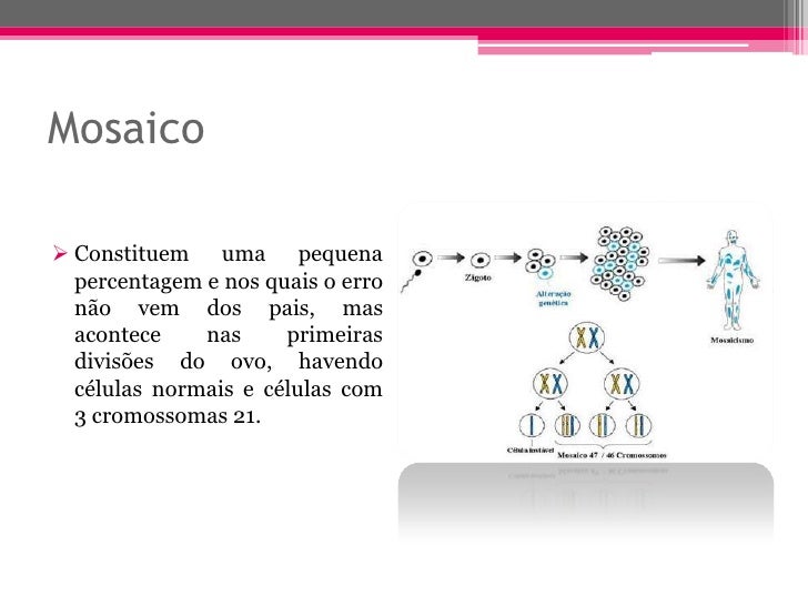 Trissomia 21