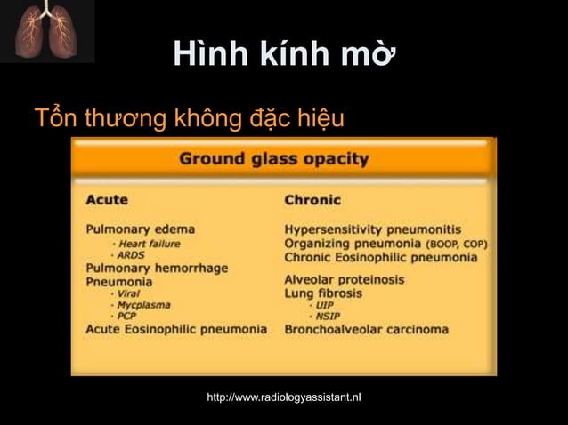 Triệu chứng trên chụp clvt phổi độ phân giải cao (hrct) | PPT