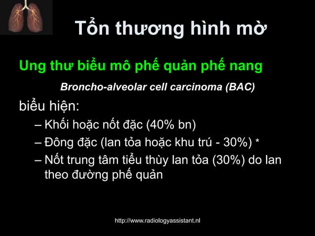 Triệu chứng trên chụp clvt phổi độ phân giải cao (hrct) | PPT