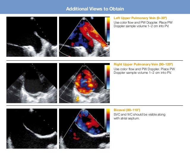 TEE Acquisition Guide