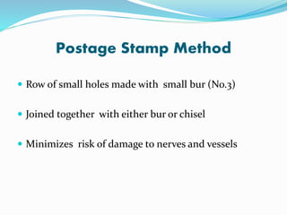 Trans Alveolar Extraction | PPTX