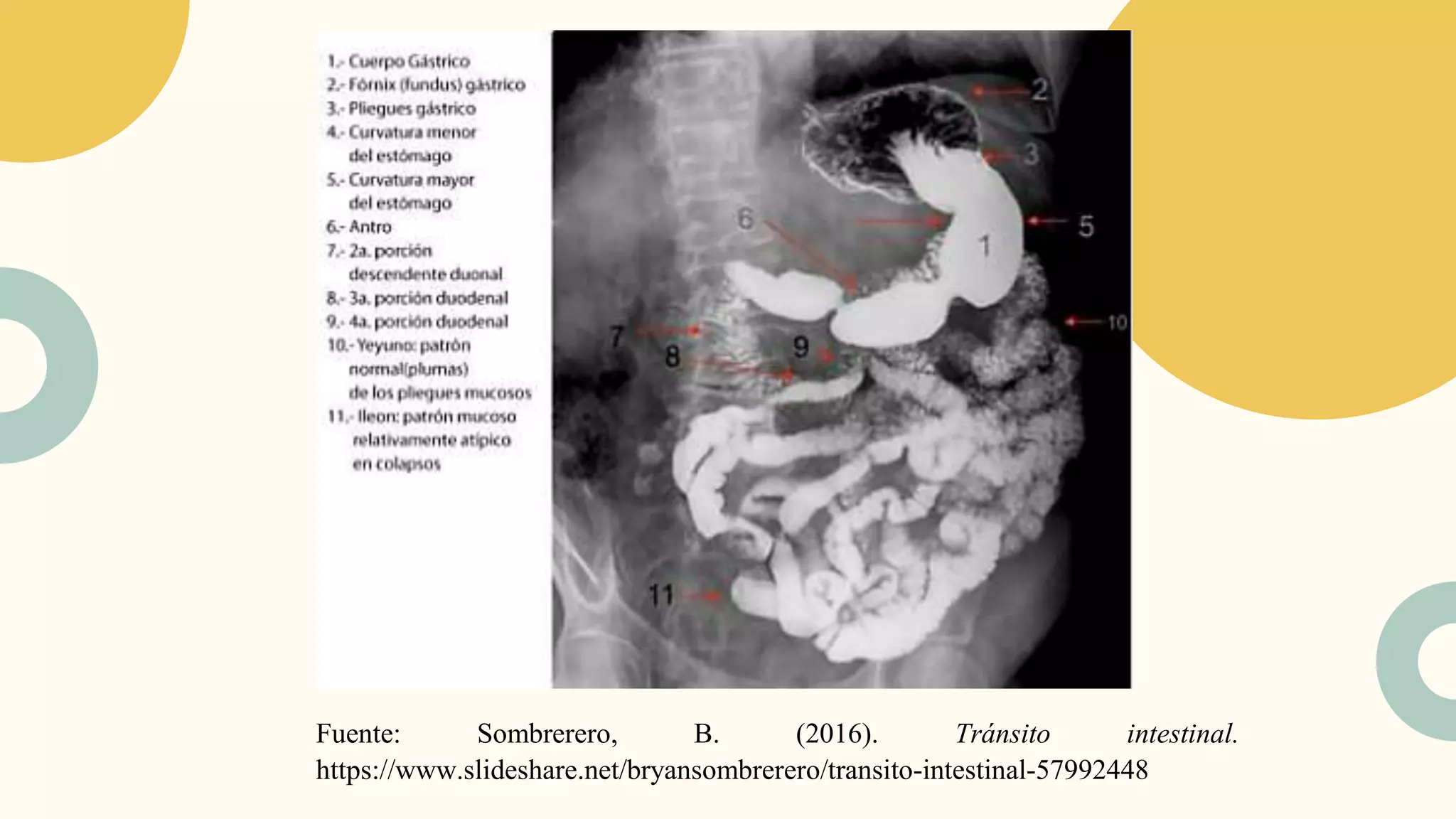 TRÁNSITO INTESTINAL, ENTEROCLISIS GS.pptx