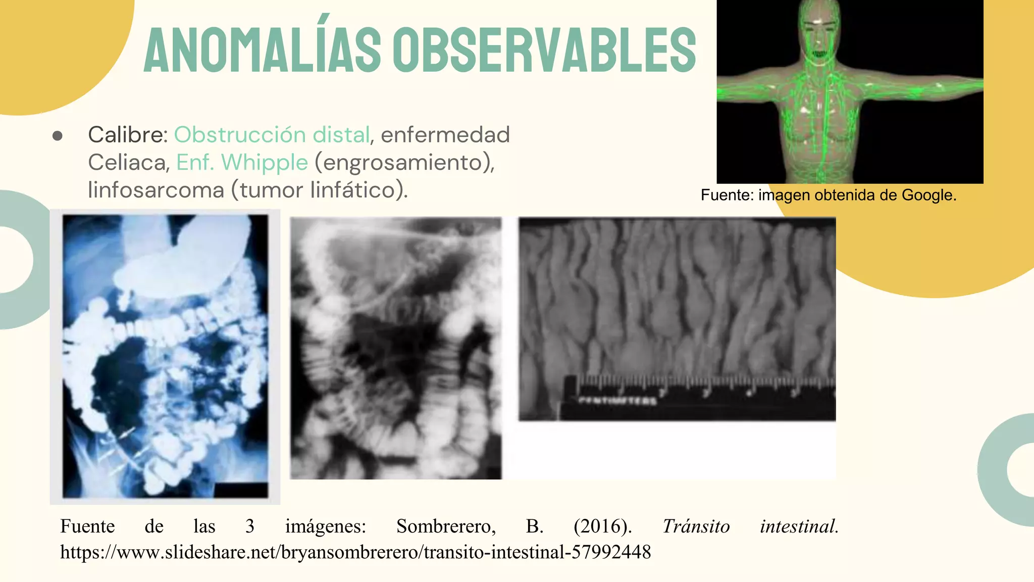 TRÁNSITO INTESTINAL, ENTEROCLISIS GS.pptx