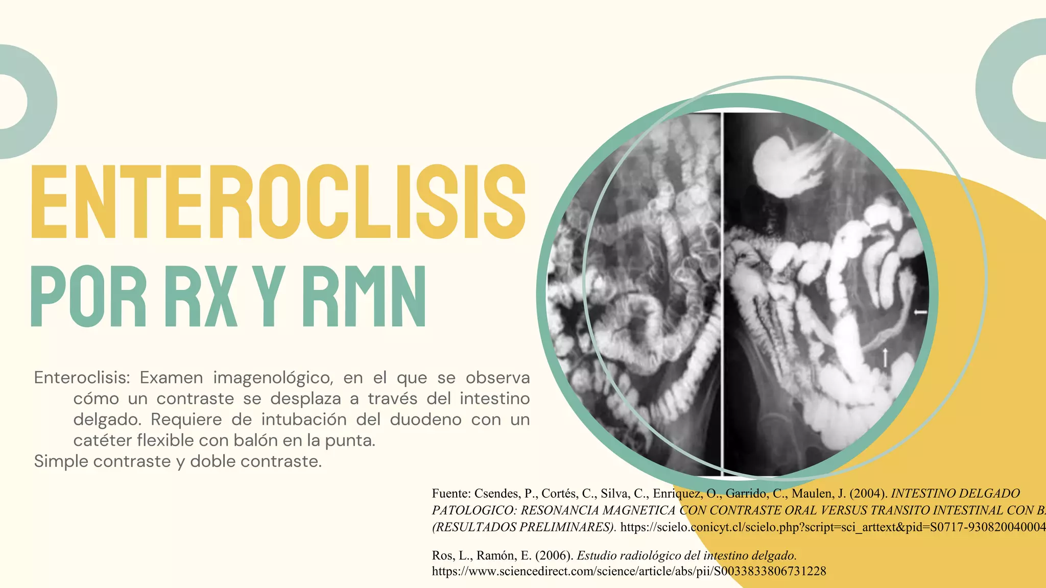 TRÁNSITO INTESTINAL, ENTEROCLISIS GS.pptx