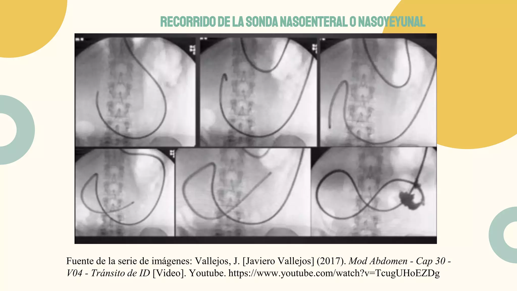 TRÁNSITO INTESTINAL, ENTEROCLISIS GS.pptx