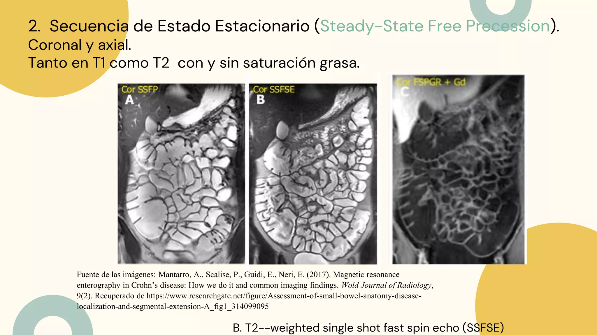 TRÁNSITO INTESTINAL, ENTEROCLISIS GS.pptx