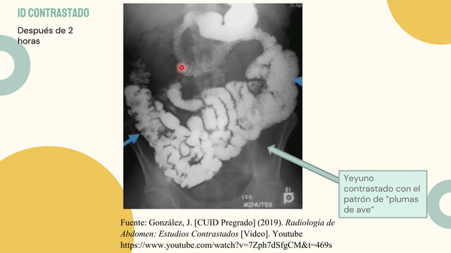 TRÁNSITO INTESTINAL, ENTEROCLISIS GS.pptx