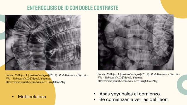TRÁNSITO INTESTINAL, ENTEROCLISIS GS.pptx