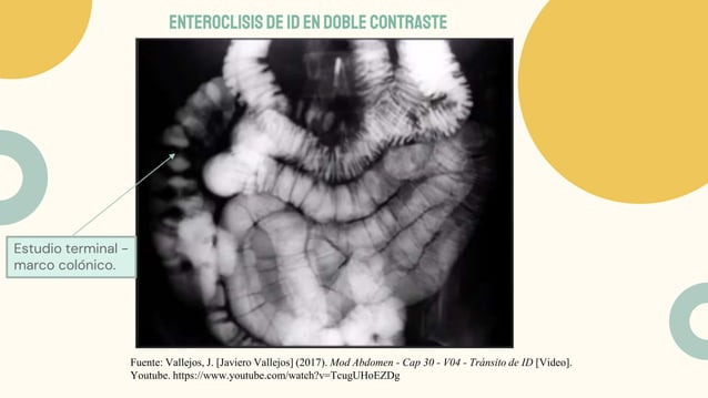 TRÁNSITO INTESTINAL, ENTEROCLISIS GS.pptx