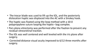 TROCAR BLADE-assisted scleral fixation for dislocated iol | PPT