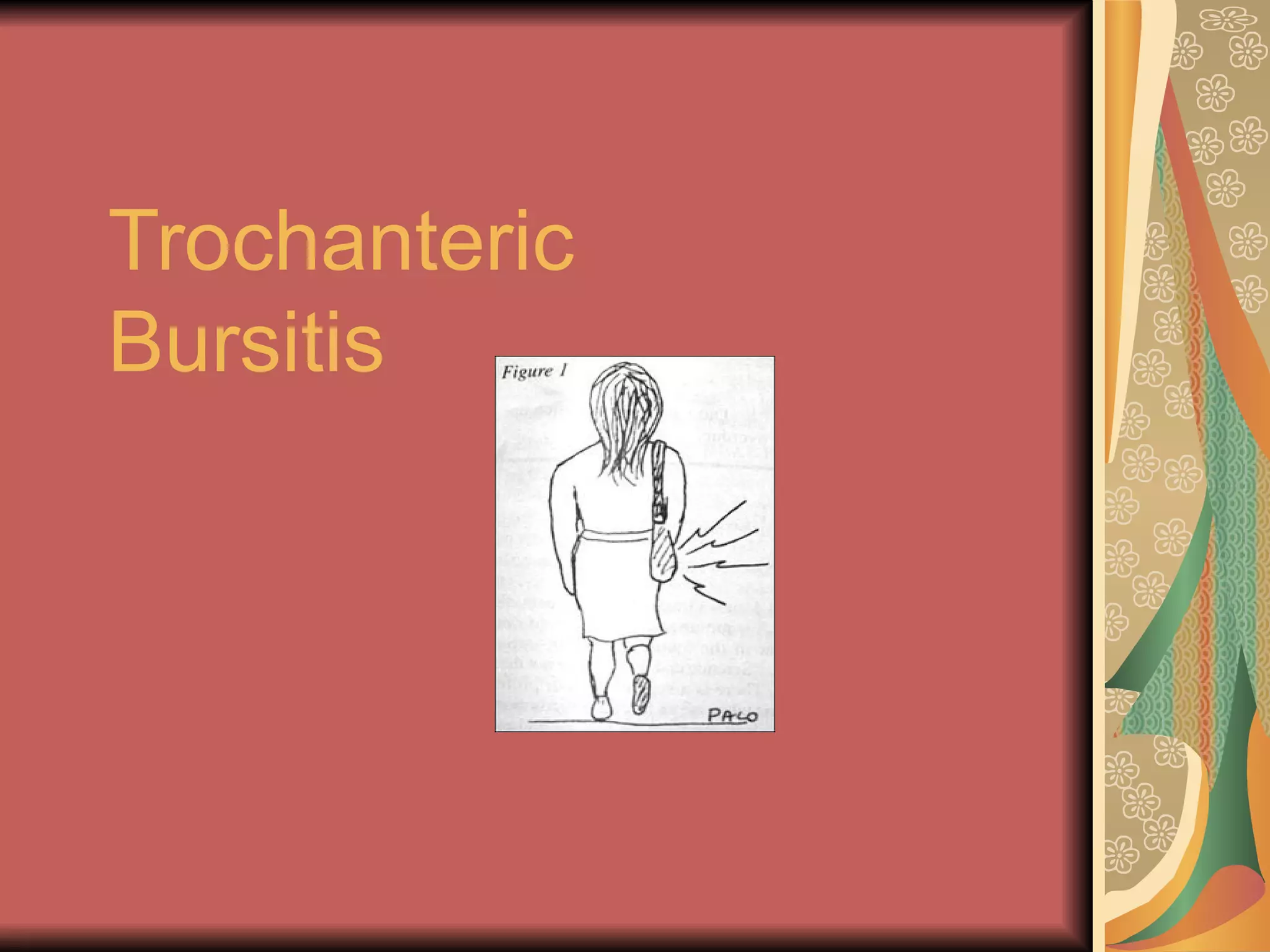 Trochanteric Bursitis | PPT