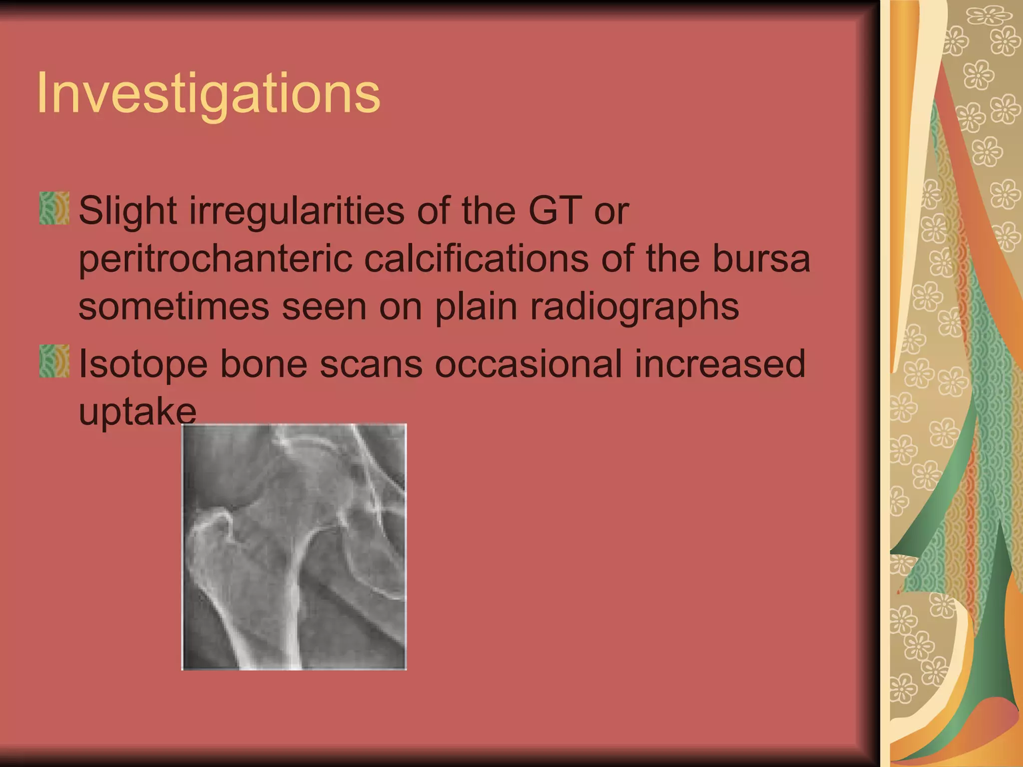 Trochanteric Bursitis | PPT