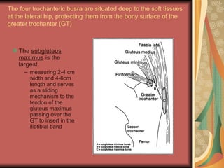 Trochanteric Bursitis | PPT