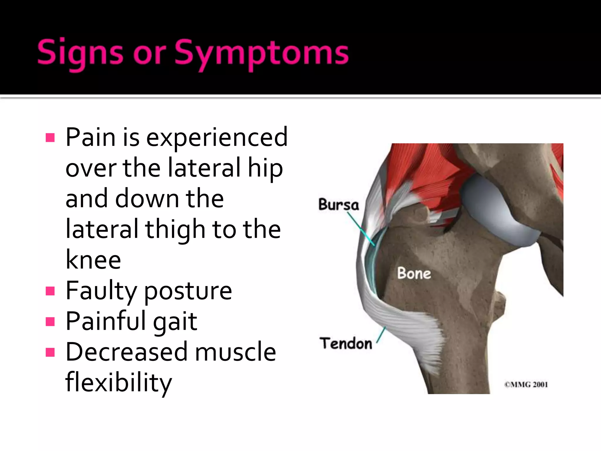 Trochanteric bursitis | PPTX