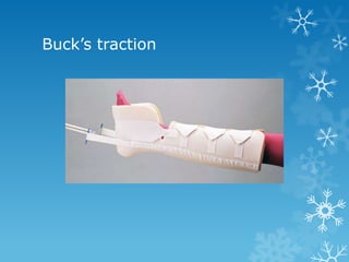 Trochanteric fracture | PPTX