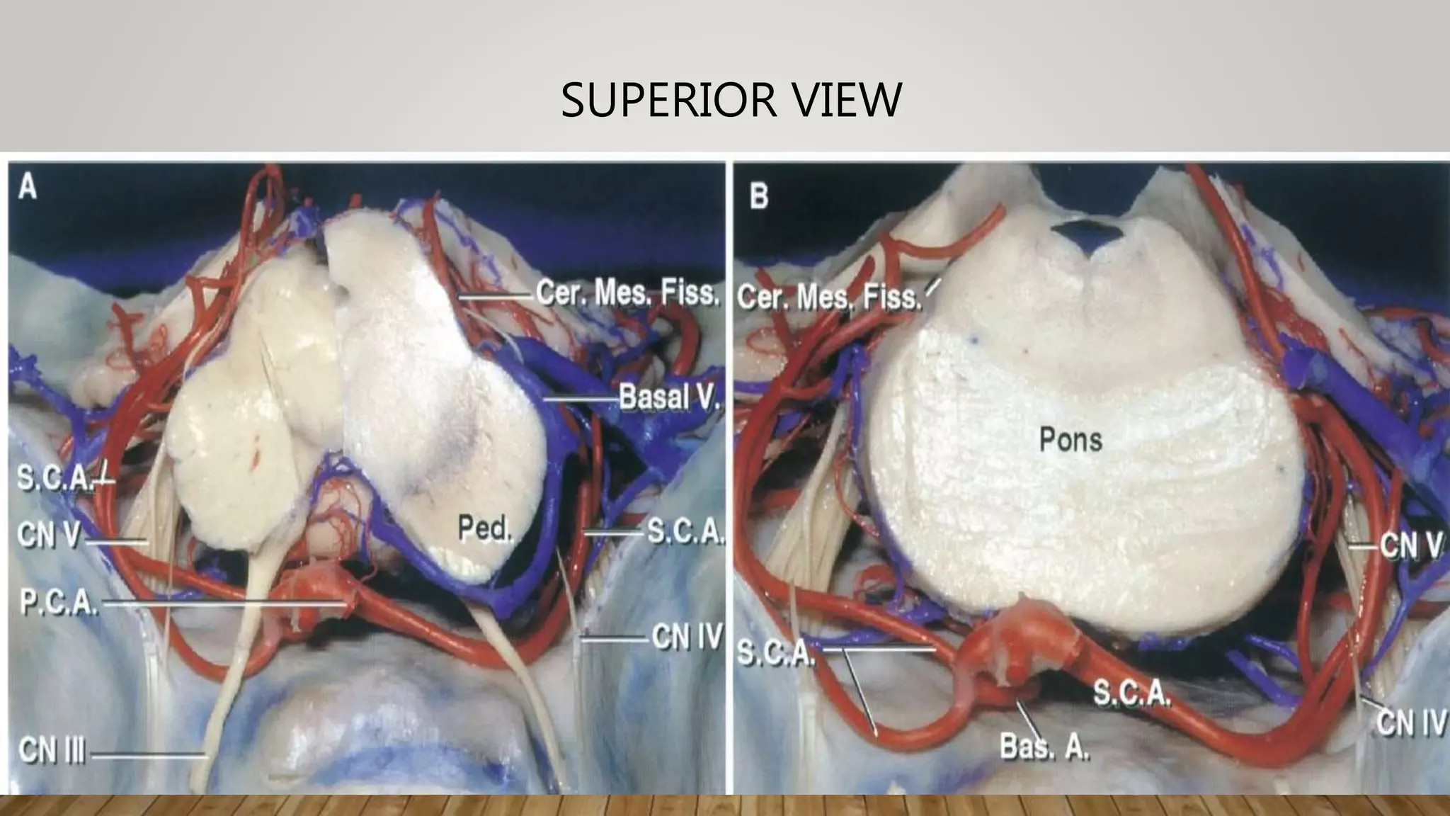 Trochlear And Abducens Nerve Ppt