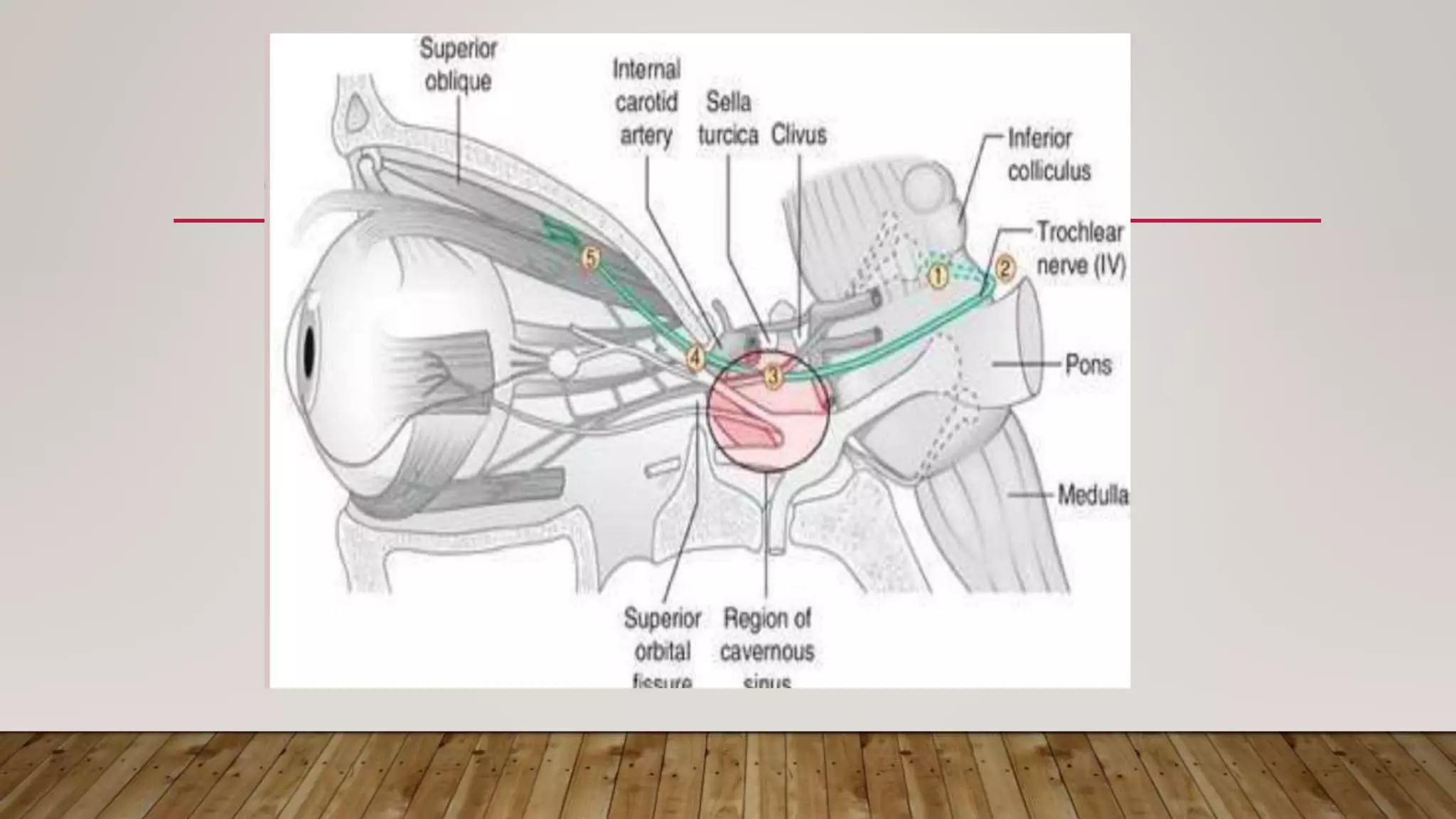 Trochlear & Abducens Nerve | PPTX