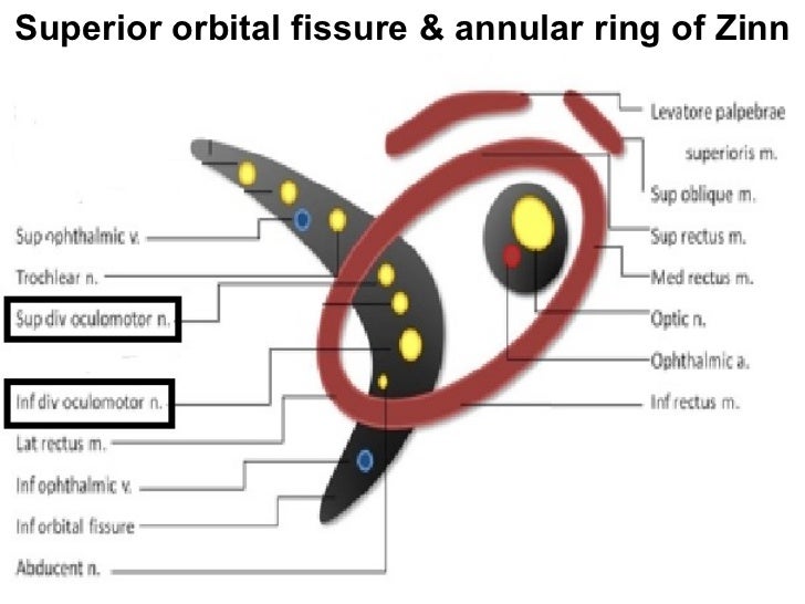 Trochlear nerve