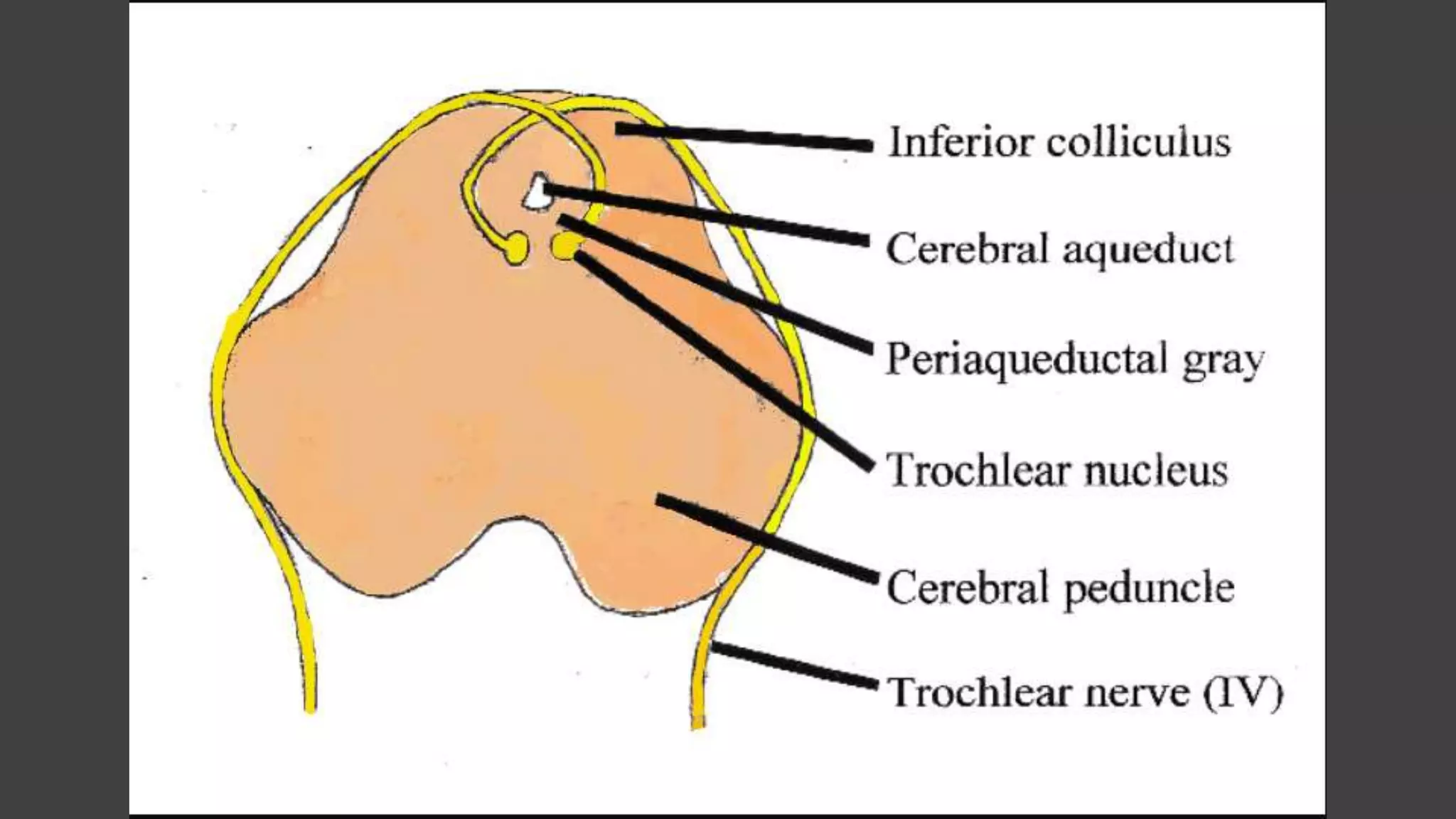 trochlear nerve.ppt