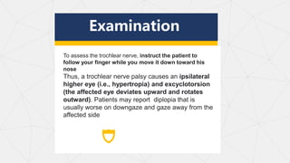 trochlear nerve.ppt