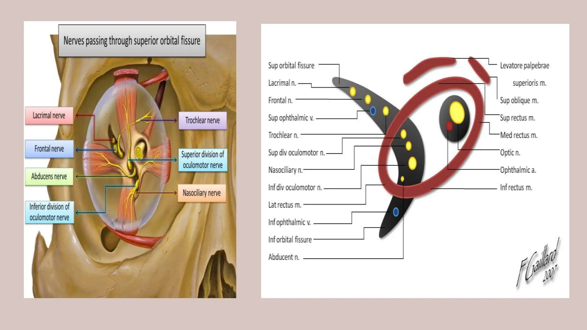 Trochlear nerve by Dr Haamid.pptx. learn about cranial nerved | PPT
