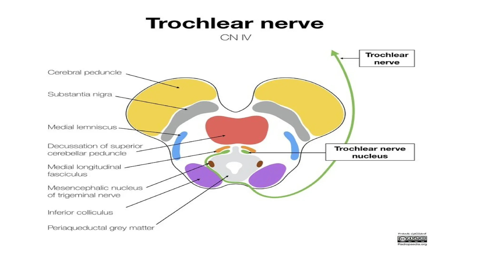 trochlear nerve( Cranial Nerve IV)group 3.pptx