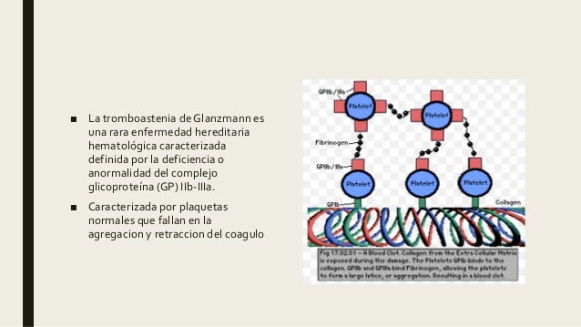 Tromboastenia de glanzmann