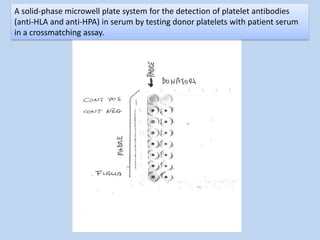 Trombocitopenia alloimmune | PPT