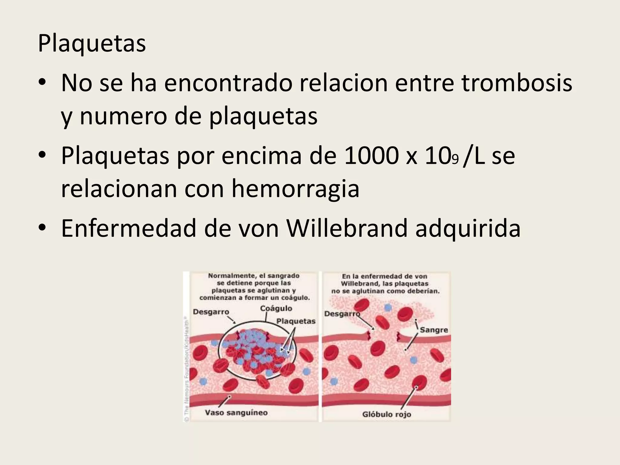 Trombocitosis esencial primaria | PPT