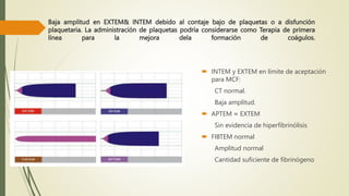 TROMBOELASTOMETRIA UTILIZACION DE ROTEM.pptx