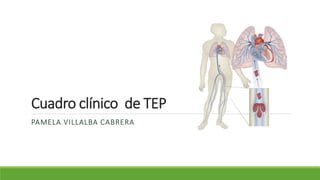 Tromboembolia pulmonar (TEP) | PPTX