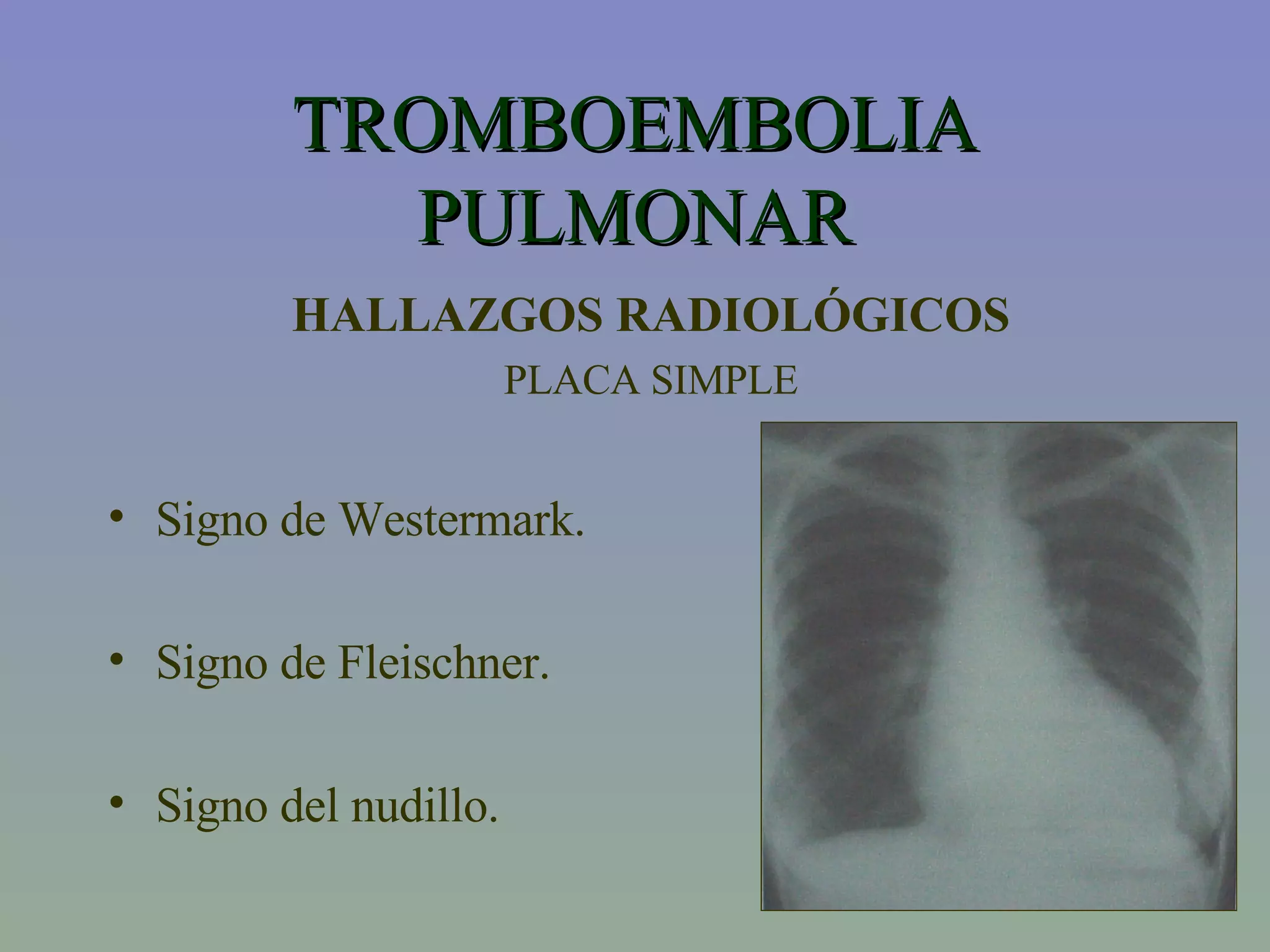 Imágenes radiográficas en la tromboembolia y el edema pulmonar | PPT ...