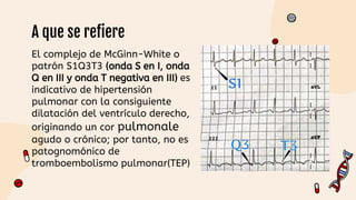 tromboembolia pulmonar.pptx