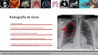 Tromboembolia Pulmonar, abordaje y tratamiento en urgencias.pptx