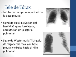TROMBOEMBOLIA PULMONAR (TEP).pptx