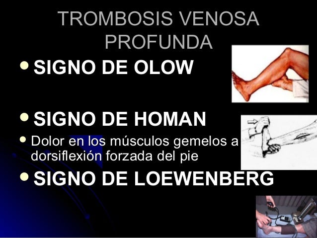 Tromboembolismo 2013