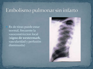 Radiografia y Tromboembolismo pulmonar | PPTX