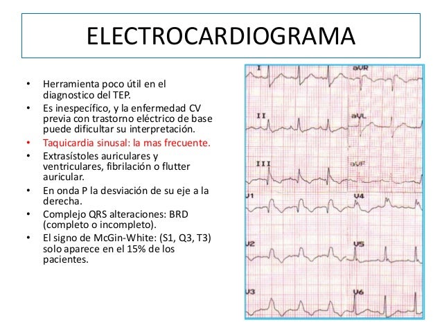 Tromboembolismo pulmonar