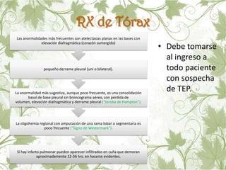 Tromboembolismo pulmonar | PPTX