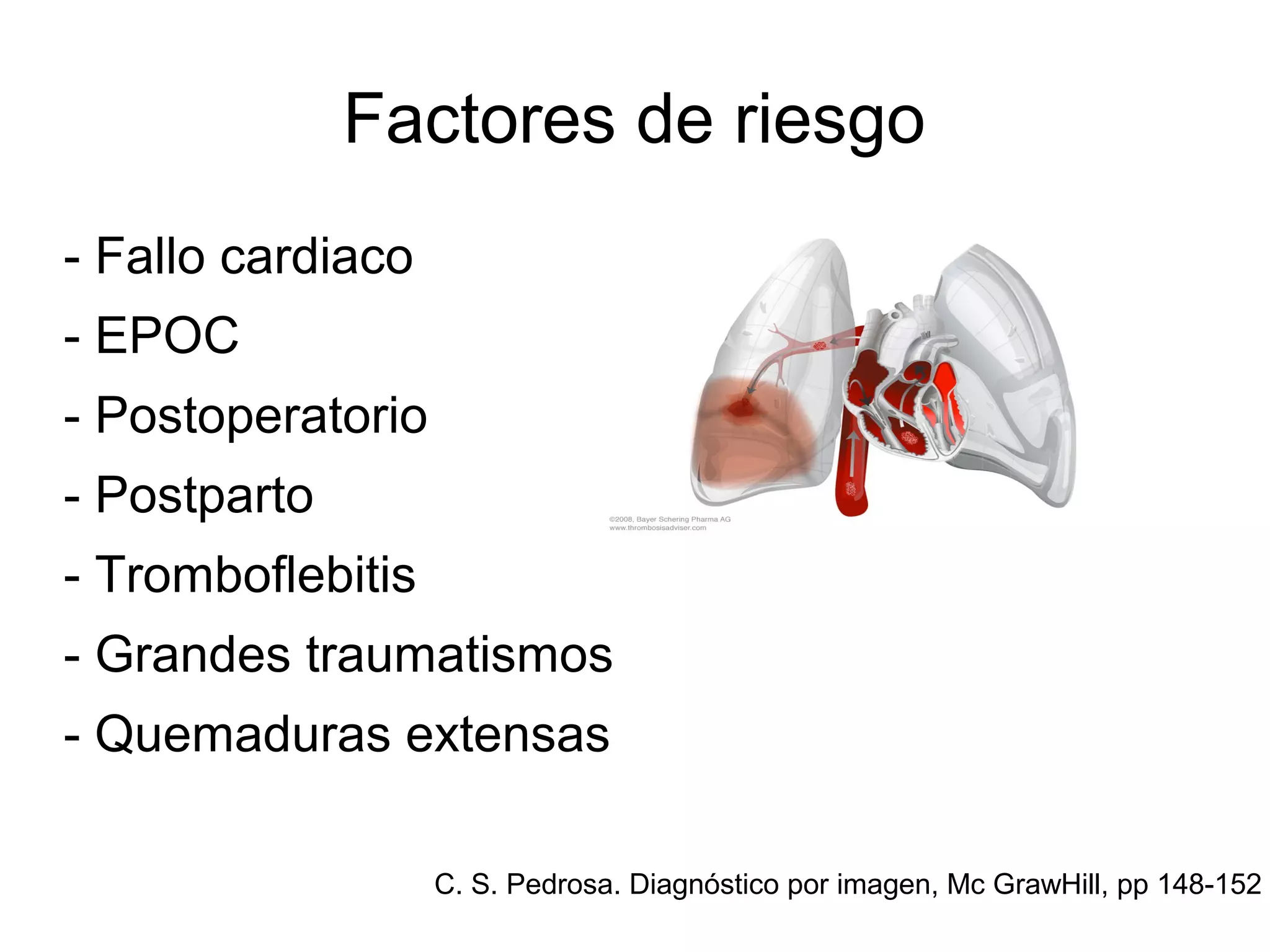 Tromboembolismo pulmonar | PPT