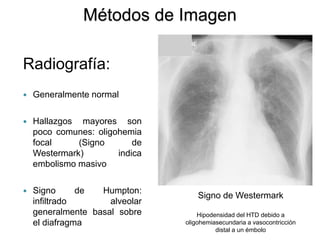 Tromboembolismo pulmonar | PPTX