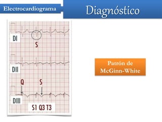 Tromboembolismo pulmonar | PPTX