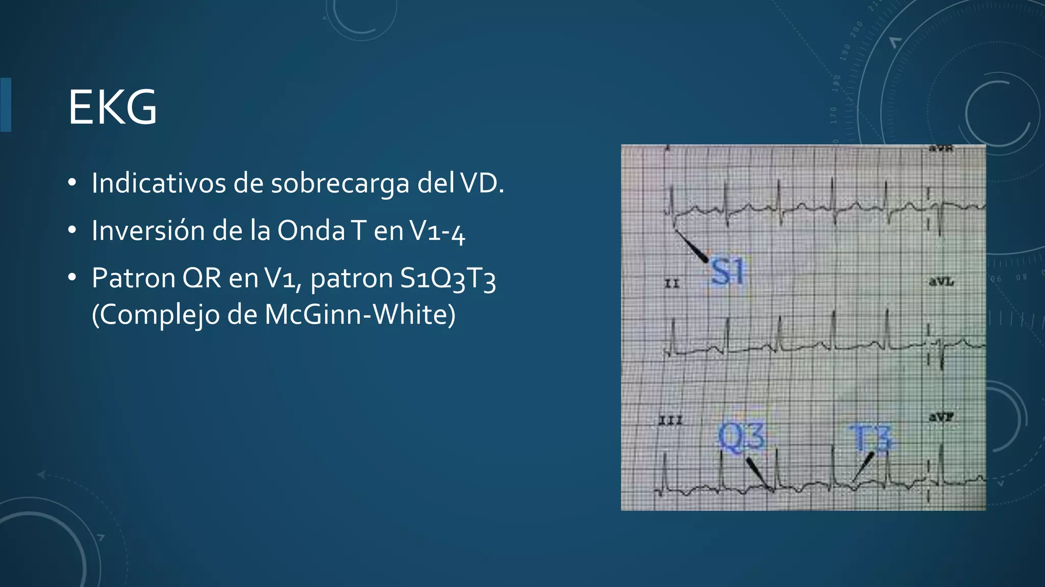 Tromboembolismo Pulmonar | PPTX