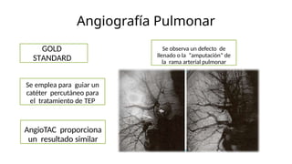 TROMBOEMBOLISMO PULMONAR DIAPOSITIVAS.. | PPTX